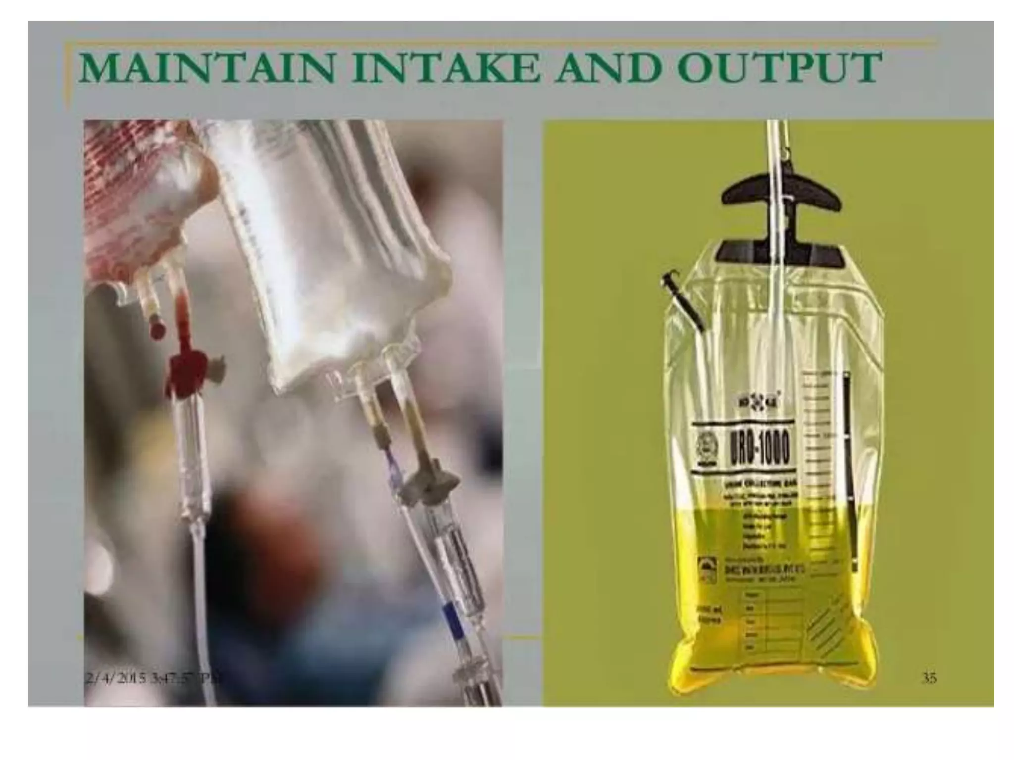 Recovery from anesthesia | PPTX