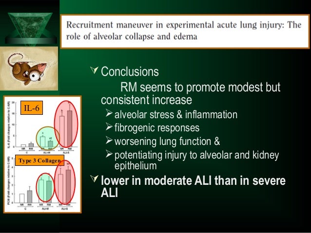 Recruitment Maneuvers in ARDS Dr Chennamchetty Vijay Kumar