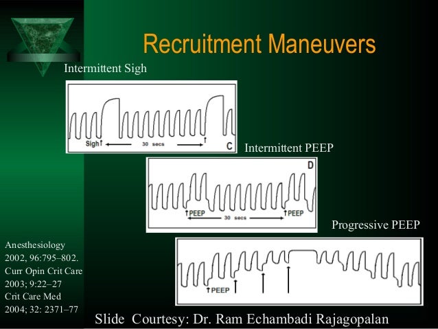 Recruitment Maneuvers in ARDS Dr Chennamchetty