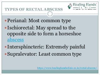 Rectal Abscess | Types, Causes, Symptoms & Treatment