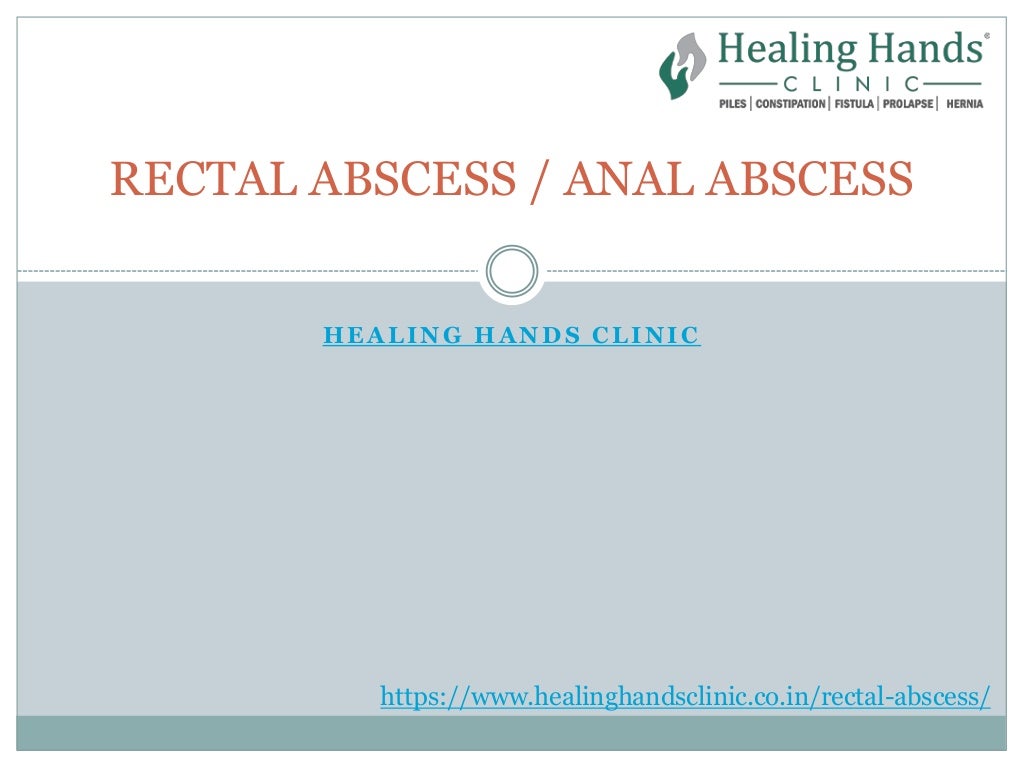 Rectal Abscess | Types, Causes, Symptoms & Treatment