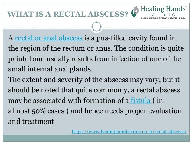 Rectal Abscess | Types, Causes, Symptoms & Treatment