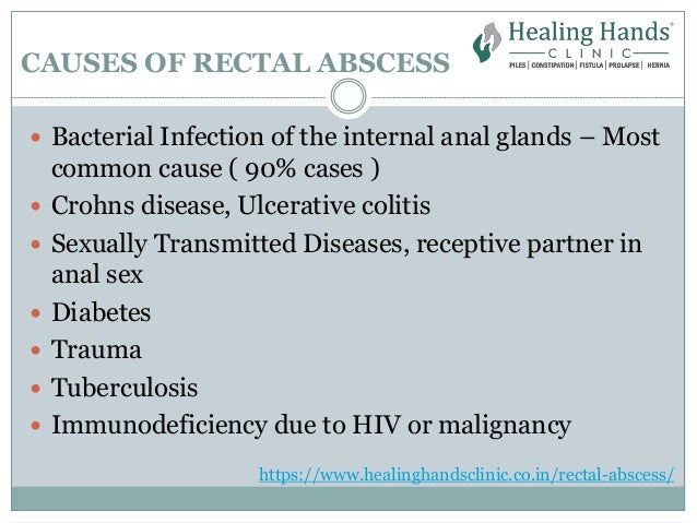 Rectal Abscess | Types, Causes, Symptoms & Treatment