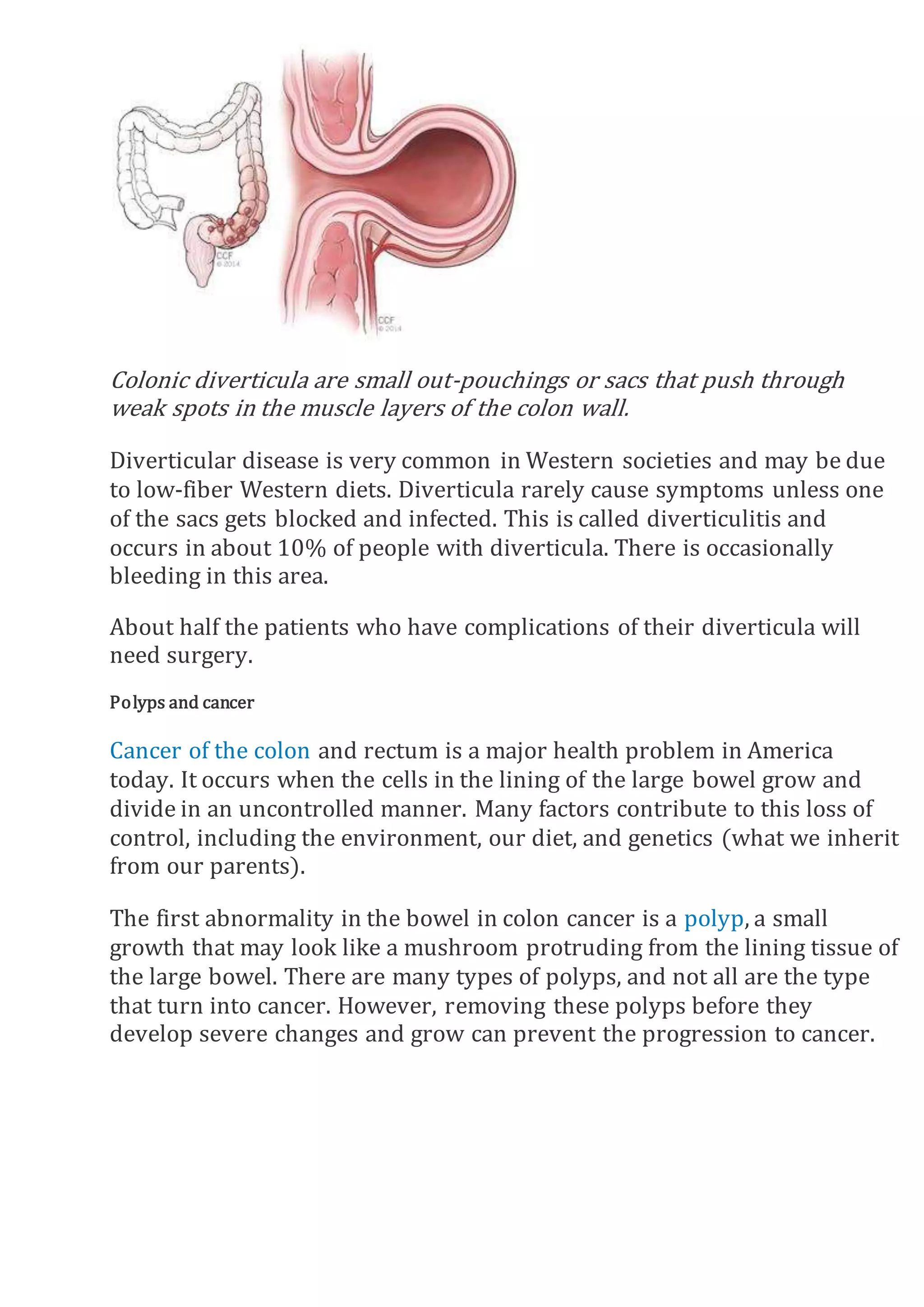 Rectal and colon diseases and conditions | DOCX | Digestive Disorders ...