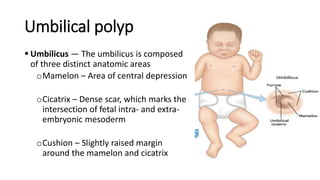 Rectal and Umbilical polyps.pptx