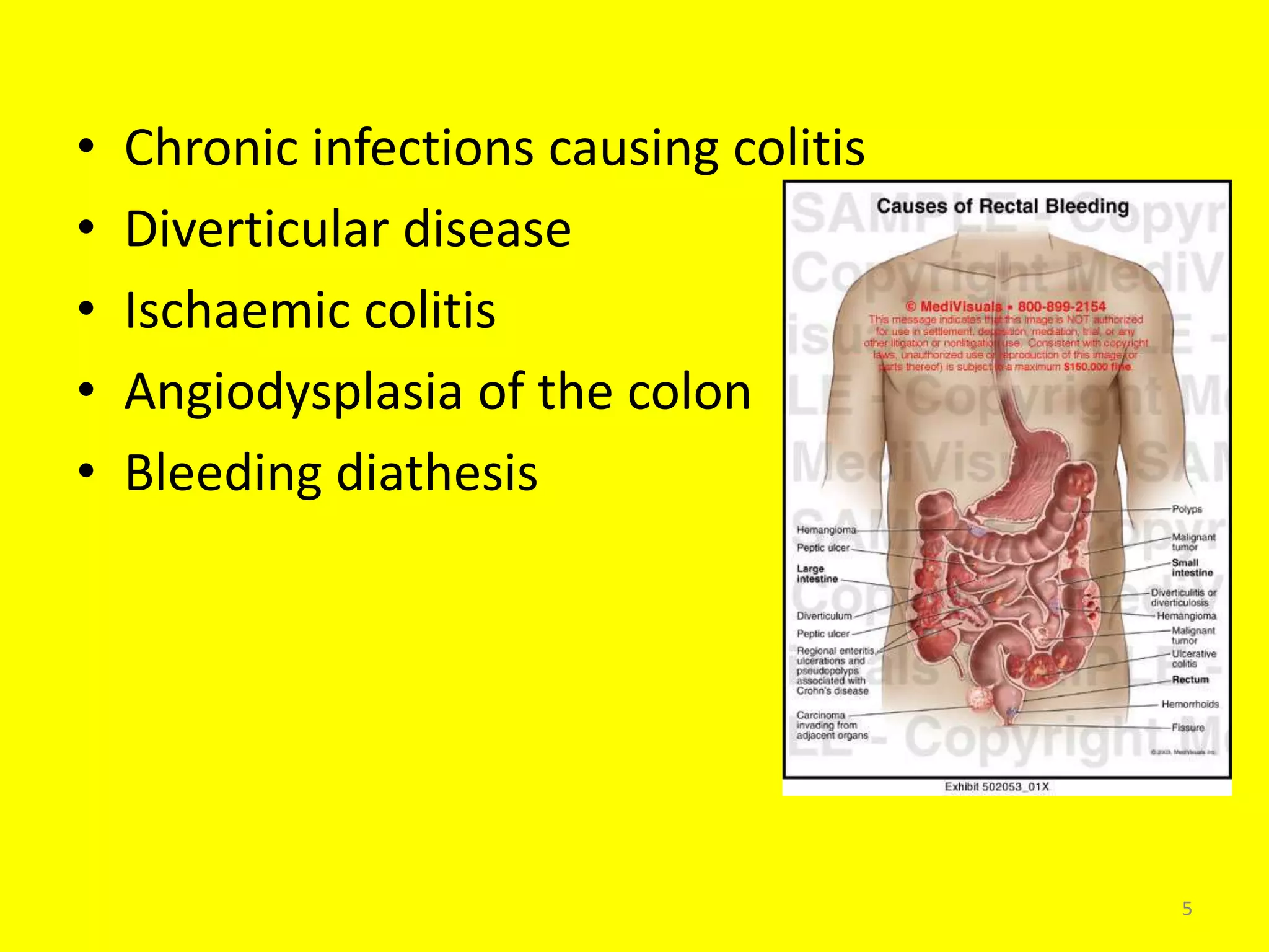 Rectal bleeding | PPTX