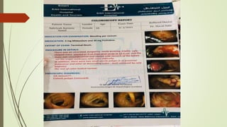 Rectal bleeding, colon cancer | PPT