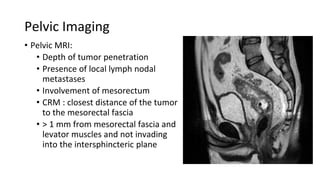 approach for rectal carcinoma and management | PPTX