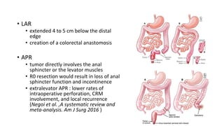 approach for rectal carcinoma and management | PPTX