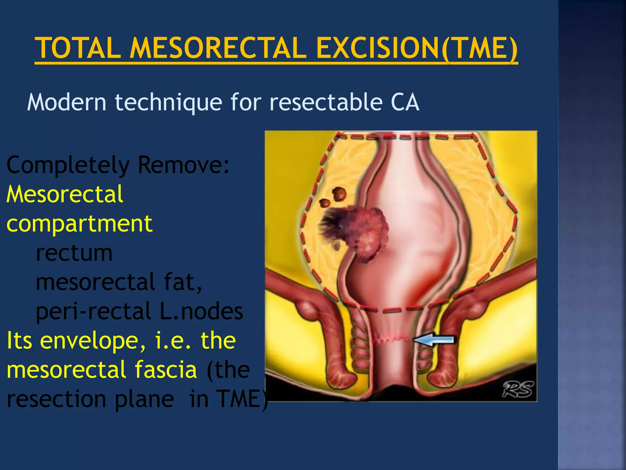 Rectal cancer MRI (for staging of CA rectum), Dr. Adnan Rashid, MD | PPTX