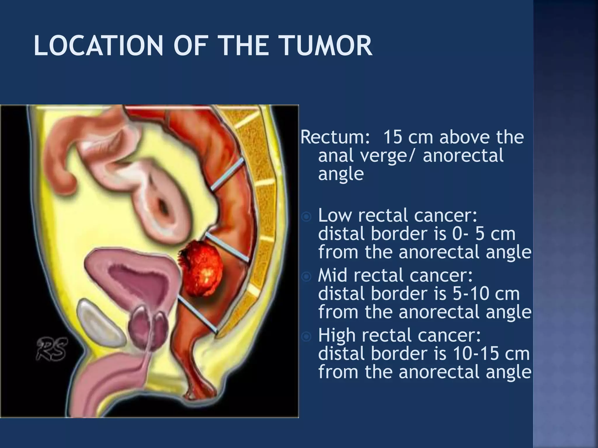 Rectal cancer MRI (for staging of CA rectum), Dr. Adnan Rashid, MD | PPTX
