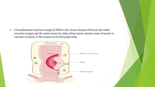 Rectal cancer surgery trials | PPTX