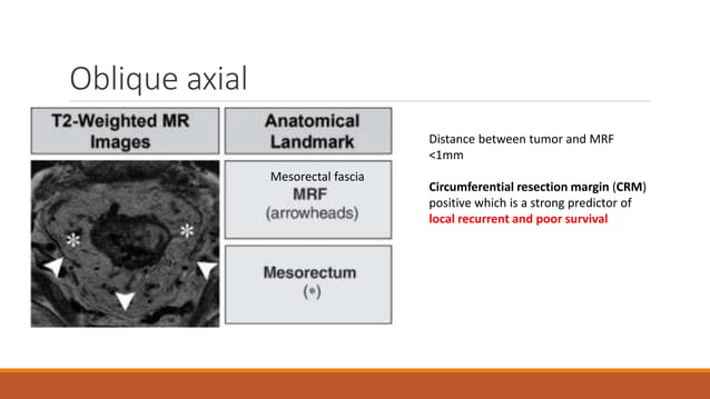 rectal cancer staging;Imaging for rectal cancer staging -Endoscopic ...