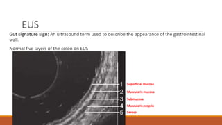 rectal cancer staging;Imaging for rectal cancer staging -Endoscopic ...