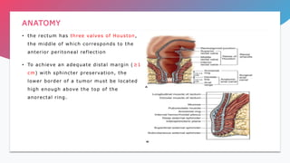 Rectal Carcinoma.pptx