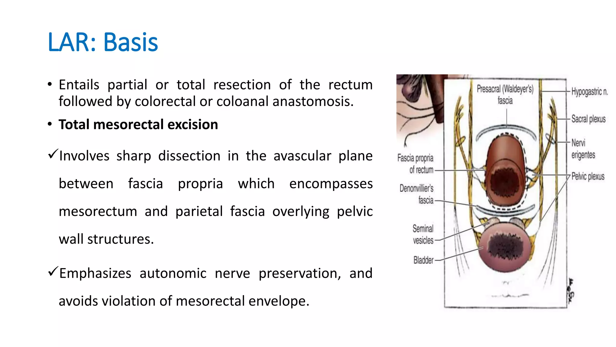 Rectal Carcinoma | PPTX