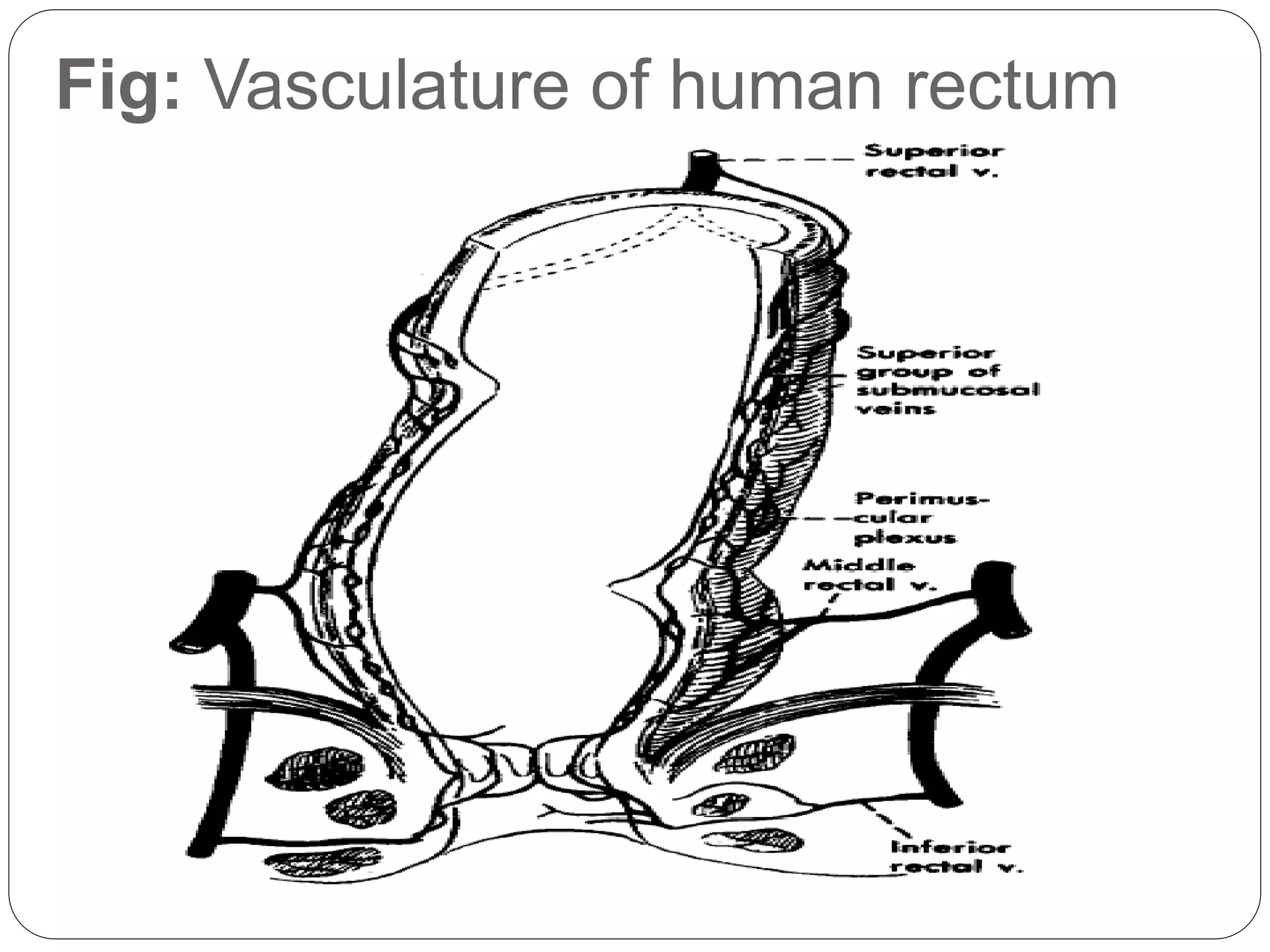 Rectal drug delivery systems | PPTX