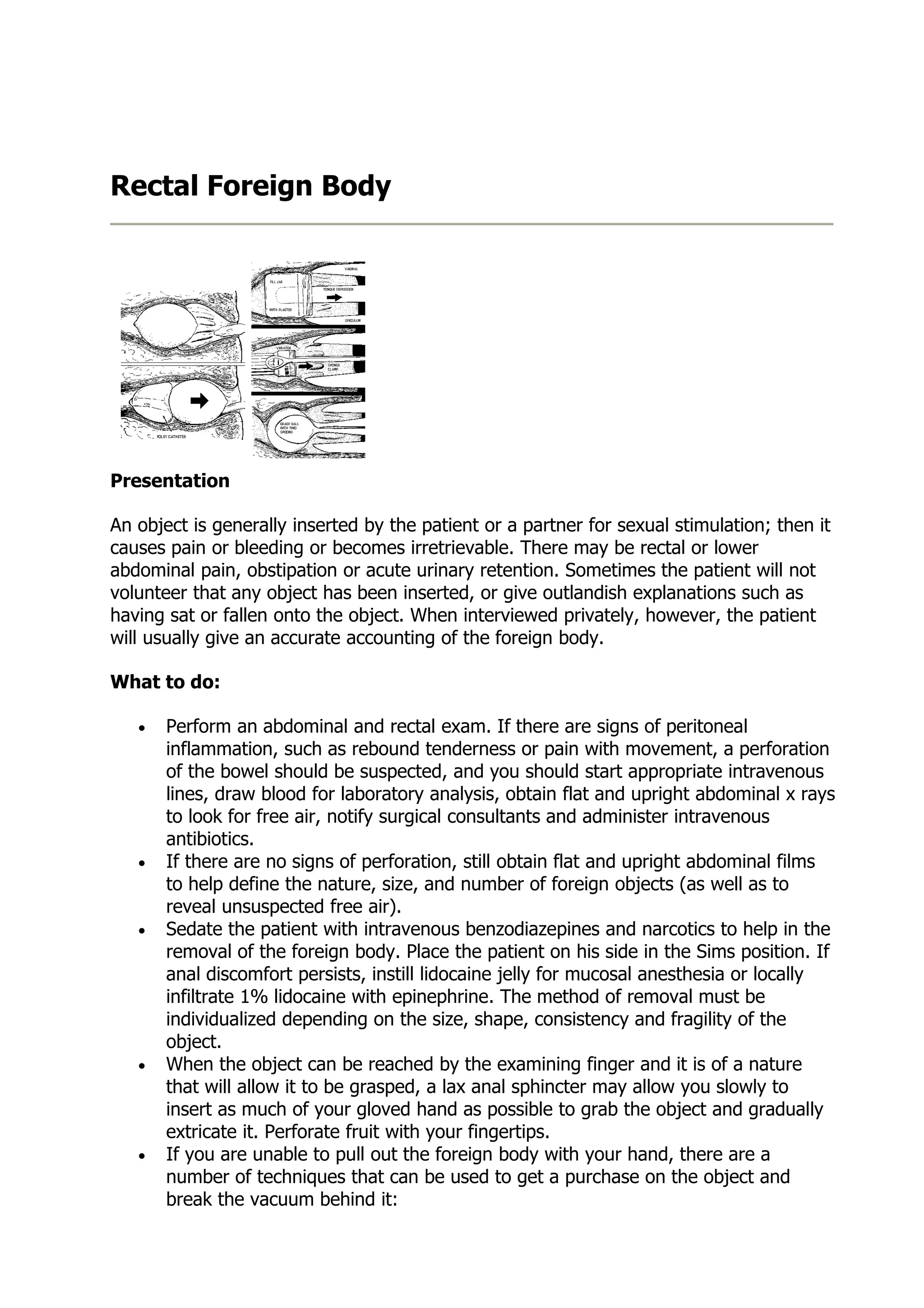 Rectal Foreign Body | DOC