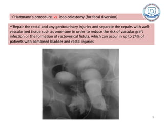 Rectal injury | PPTX