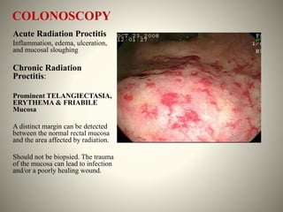 Radiation induced Rectal morbidity | PPTX