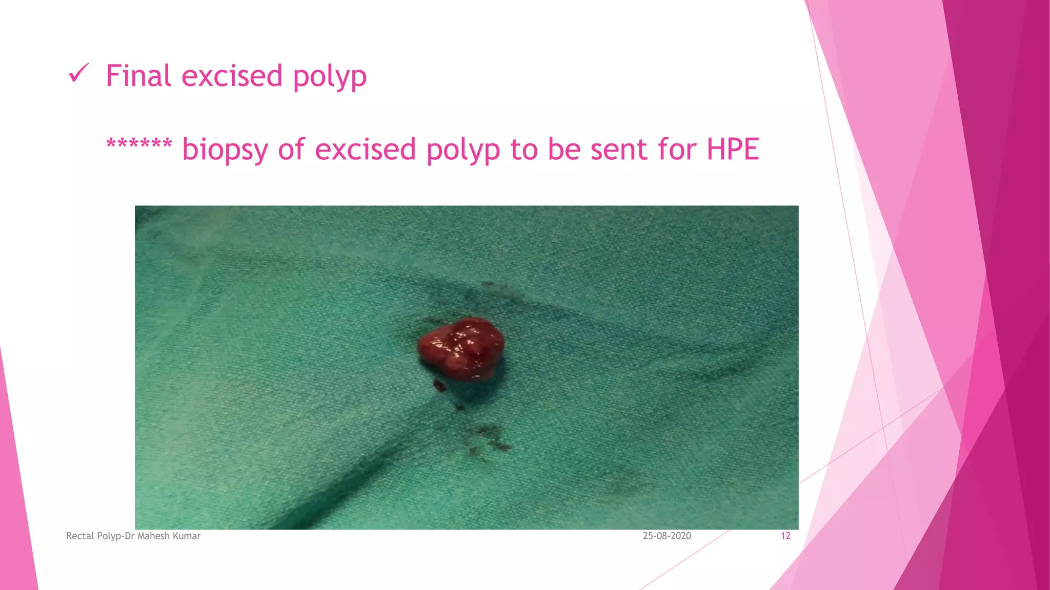 Rectal polyp ppt 25-08-2020 dr mahesh | PDF