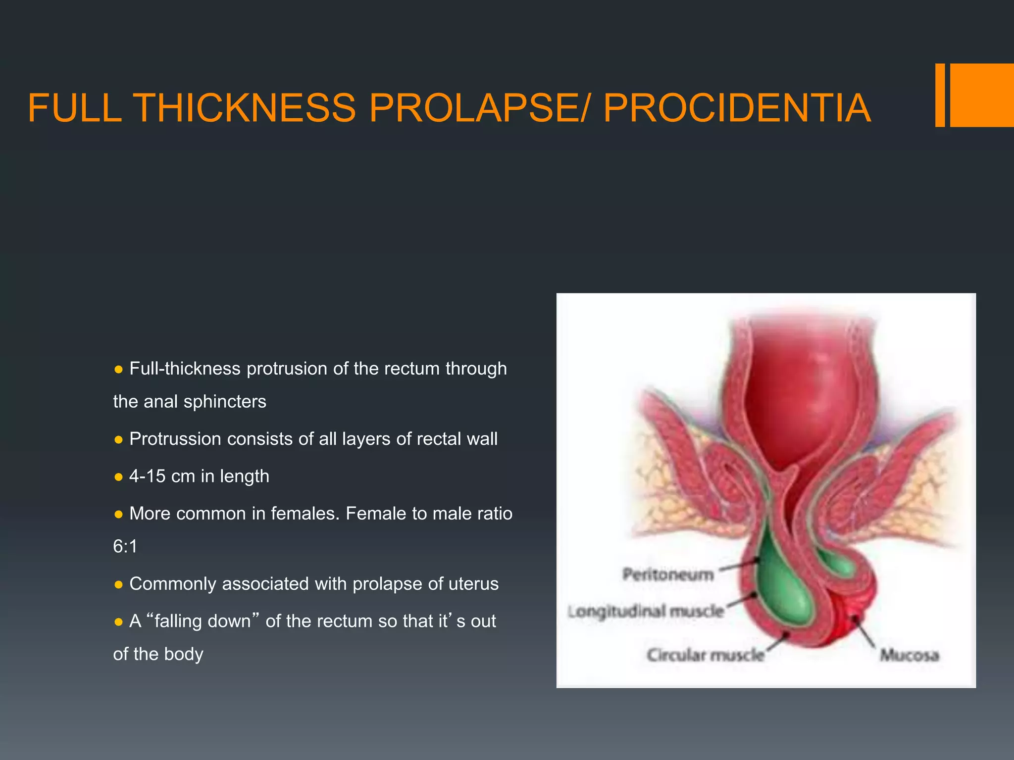 Rectal prolapse | PPTX