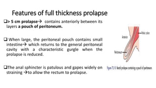 Rectal prolapse (Surgical anatomy of rectum, pathology and management0 ...