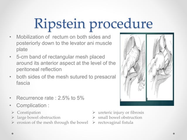 Rectal prolapse (D1) | PPTX | Digestive Disorders | Diseases and Conditions