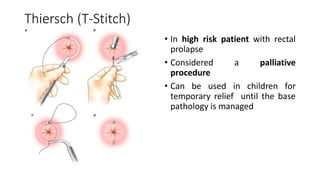 RECTAL PROLAPSE.pdf | Digestive Disorders | Diseases and Conditions