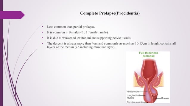 RECTAL prolapse.pptx