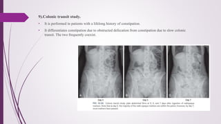 RECTAL prolapse.pptx