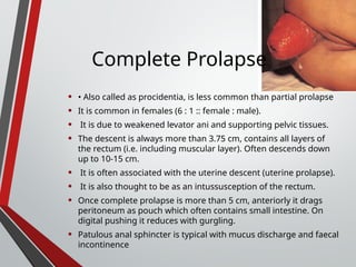 Causes, risk factors, management and complications associated with ...