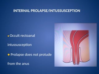 rectal prolapse. SYED OBAID PROFESSOR OF SURGERY | PPTX