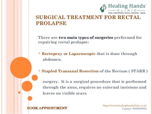 Rectal Prolapse Causes Symptoms And Treatment