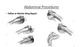 Rectal prolapse pathophysiology and management | PPTX