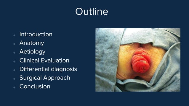 Rectal Prolapse presentation.pdf