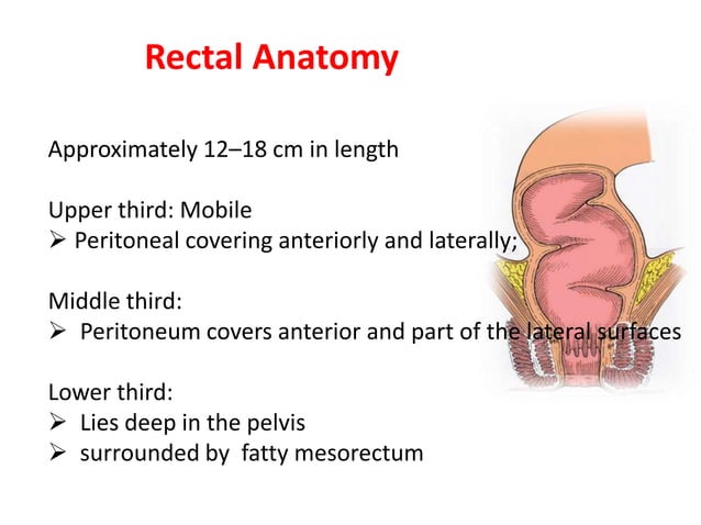Rectal prolapse surgical approaches | PPTX