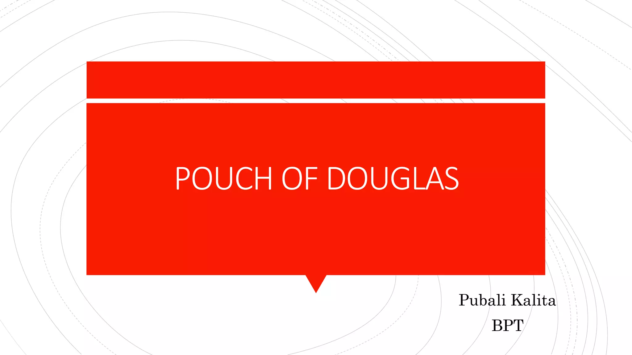 Rectouterine Pouch.pptx