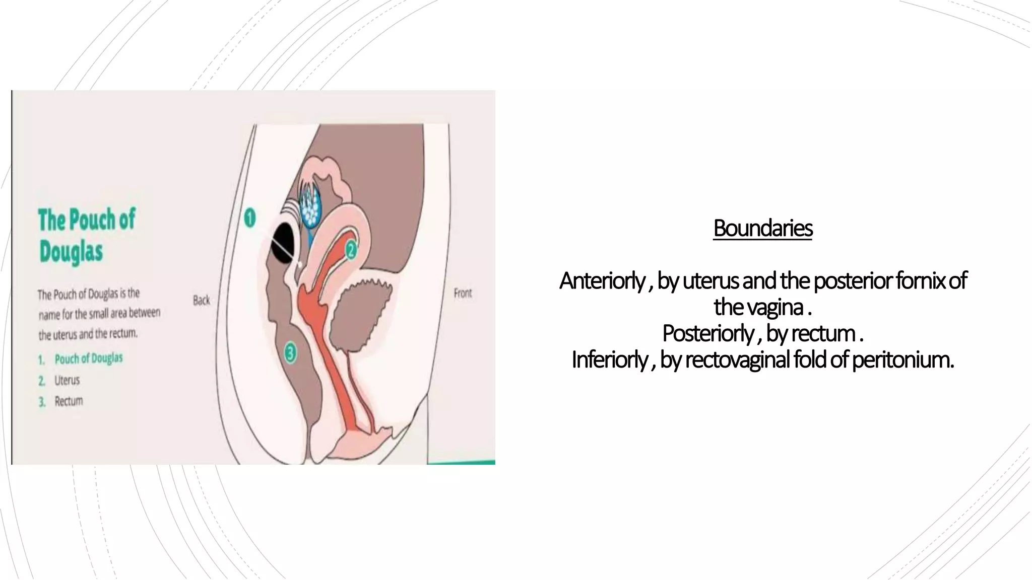 Rectouterine Pouch.pptx