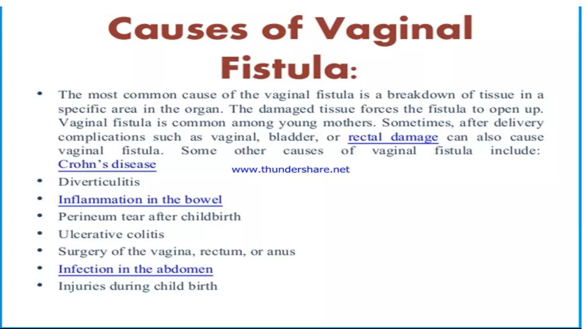Rectovaginal fistula by Dr Manoj chellani | PPTX