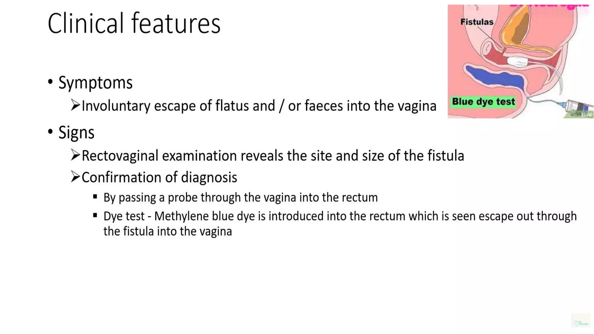 Rectovaginal fistula by Dr Manoj chellani | PPTX