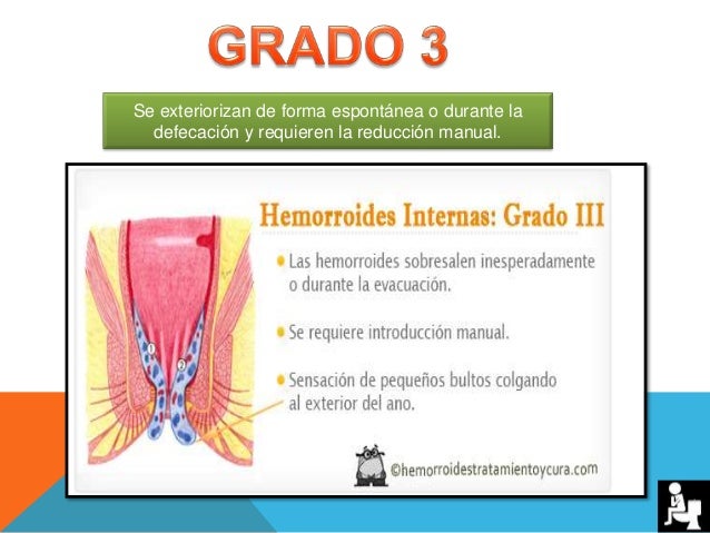 Patología de Ano y Recto