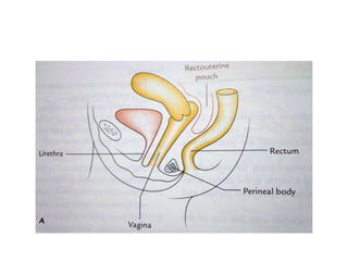 Rectum.pptx