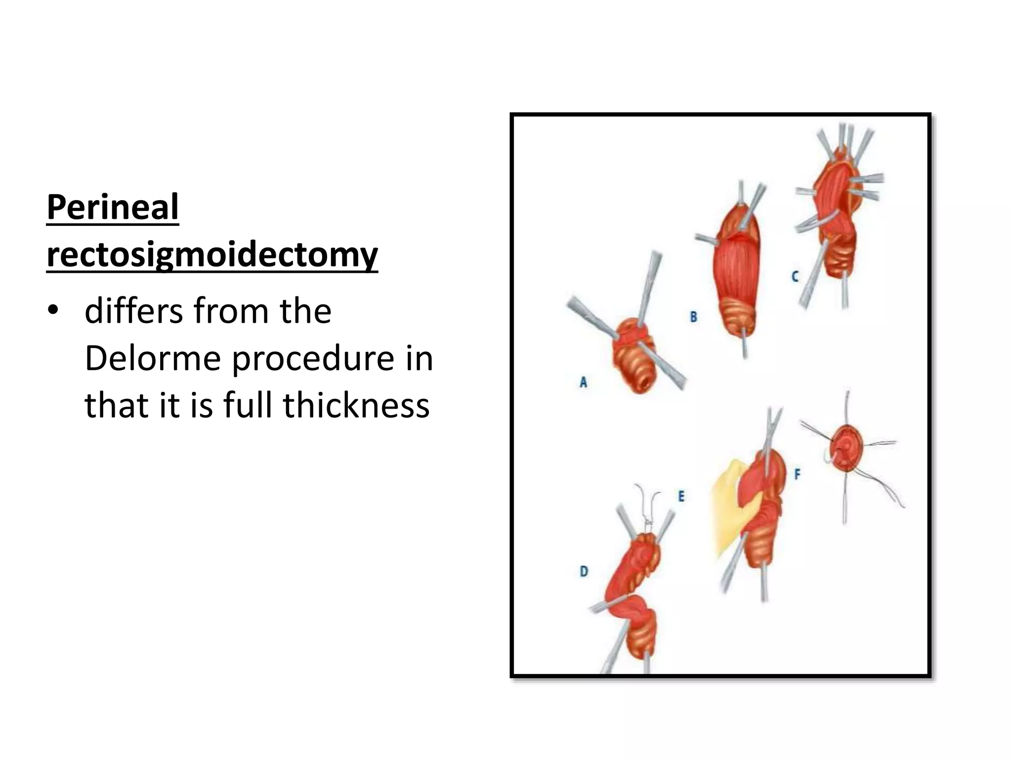 rectum_anatomy_and_physiology_clinical_features.ppt