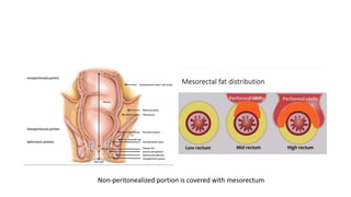 Rectum cancer surgery. Standards of Surgical practice for resectable ...