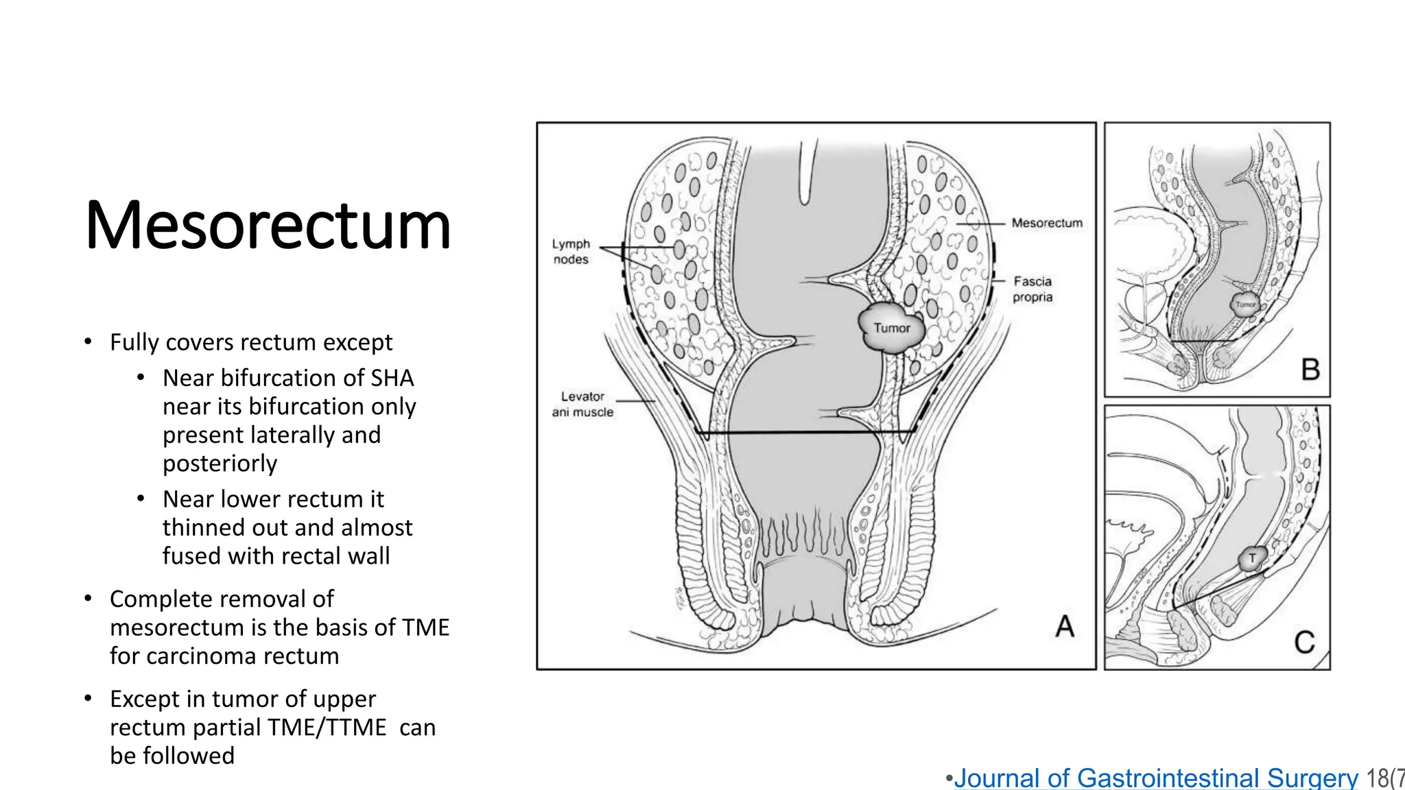 surgical anatomy of rectum | PPTX