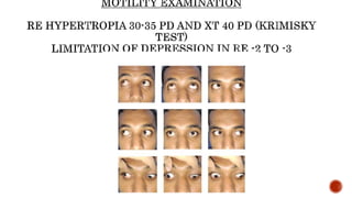 Rectus muscle plication for strabismus surgery final .pptx