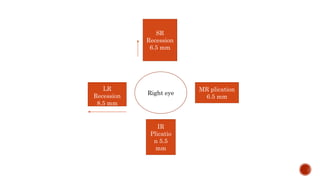 Rectus muscle plication for strabismus surgery final .pptx