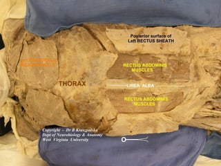 Rectus sheath | PPT