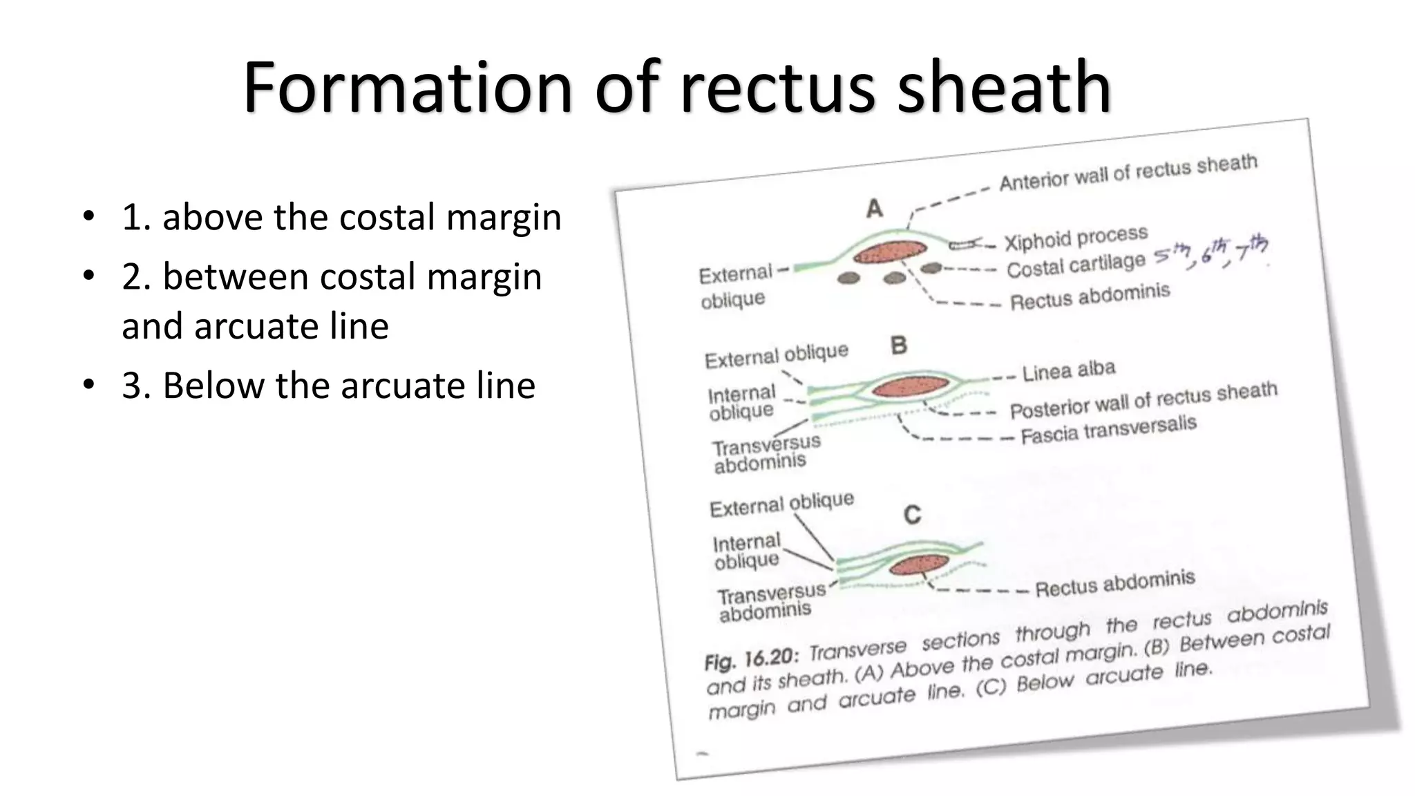 Rectus Sheath anatomy.pptx